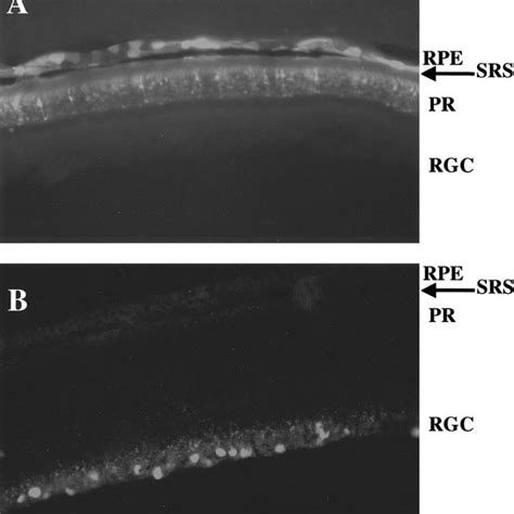 Dependence Of Retinal Cell Transduction On Route Of Injection Of