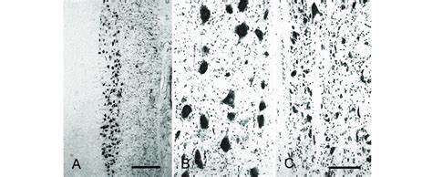 Photomicrographs Showing Motor Neurons In Treated Cats A An