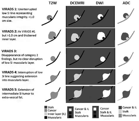 Schematic Illustration Of Mpmri Appearances Of Vi Rads Scores 1 5 Using