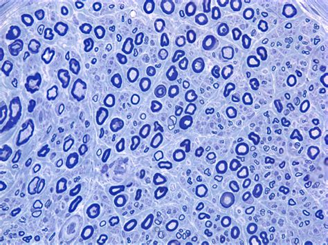 Peripheral Nerve Histology