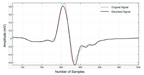 Original And Denoised Electrocardiogram Ecg Signal Using Daubechies Download Scientific