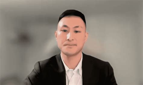 How To Code An Open Radical Nephrectomy With Retroperitoneal Lymph Node Dissection