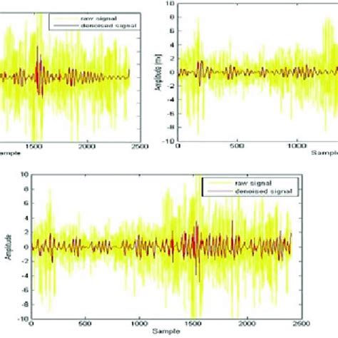 Emg Signal Processing Steps Download Scientific Diagram