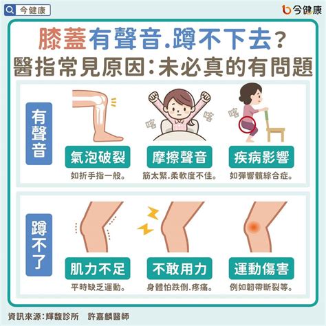 膝蓋有聲音是退化蹲不了有問題醫教自我檢測2招保養 今健康
