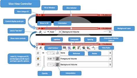 visualize 3d images using 3d slicer view controllers module machine