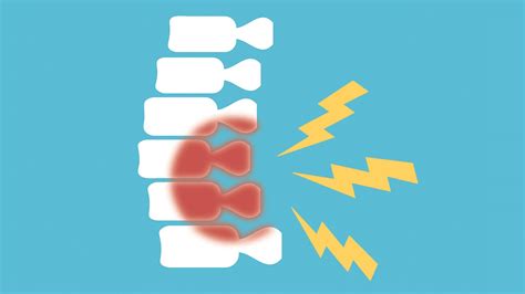 Best And Worst Sex Positions For Back Pain Everyday Health