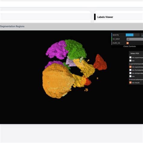 Brainchop Rendering Segmentation Output In 3d Download Scientific