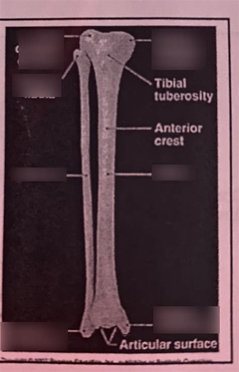 Right Tibia And Fibula Diagram Quizlet