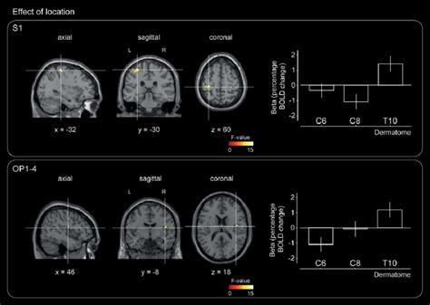 Statistical Parametric Maps Threshold At P
