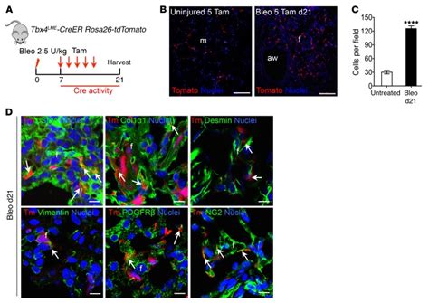 Transcription Factor Tbx4 Regulates Myofibroblast Accumulation And Lung