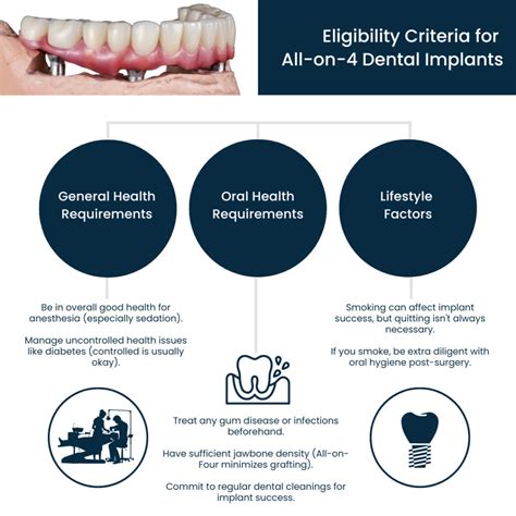 Eligibility Criteria For All On 4 Dental Implants Nyc Dental Implants