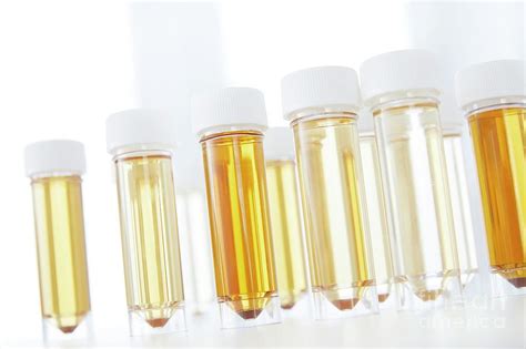 Dilute Urine Sample
