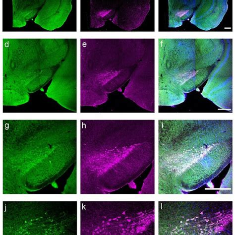 Photomicrographs Of A Representative Coronal Section Of A Mouse Brain Download Scientific