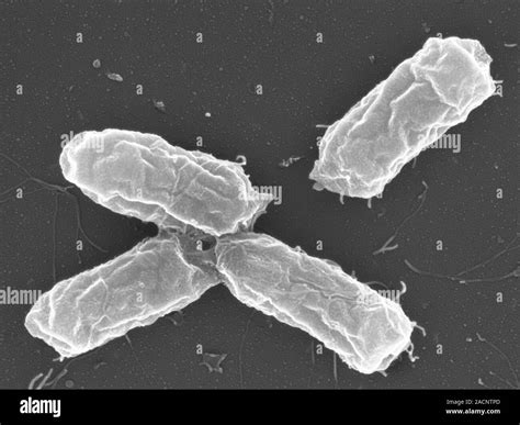 Salmonella Typhimurium Electron Micrograph