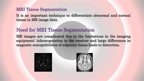 Mri Tissue Segmentation Basics Ppt