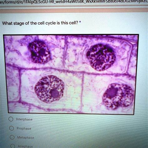 What Stage Of The Cell Cycle Is This Cell Interphase Prophase Metaphase Anaphase
