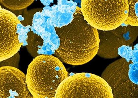 The Clear Trial Decolonization Routine Associated With Lower Infection Risk Among Mrsa Carrier