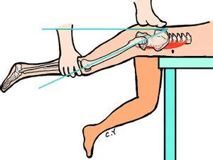 Prone Hip Extension Test WikiSM Sports Medicine Wiki