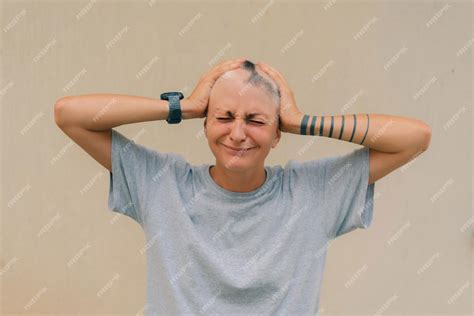 Premium Photo Real Alopecia Areata In A Young Girl A Bald Head In A Person Diffuse Alopecia