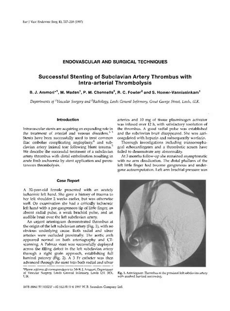 Pdf Successful Stenting Of Subclavian Artery Thrombus With Intra Arterial Thrombolysis