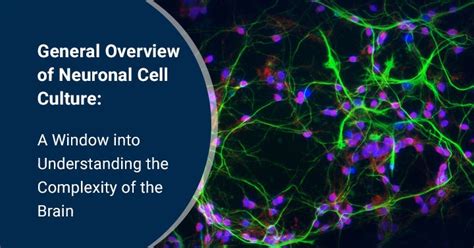 General Overview Of Neuronal Cell Culture A Window Into Understanding
