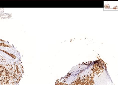 Openslide And Qupathpixelation And Background Color Abnormality In Images Read By Openslide