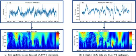 figure 1 from data driven model for improving meg epileptic spike