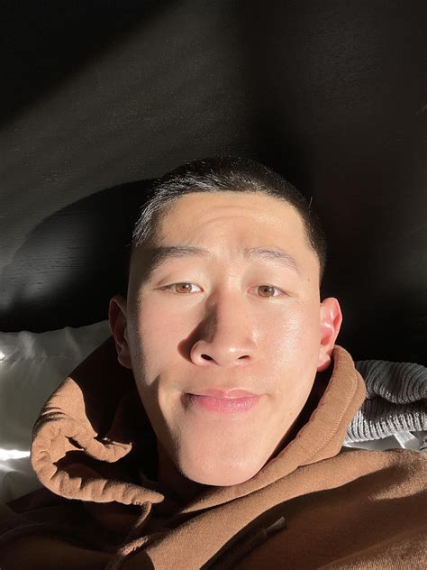 21m With Class Three Underbite That Had Braces Previously I Want To