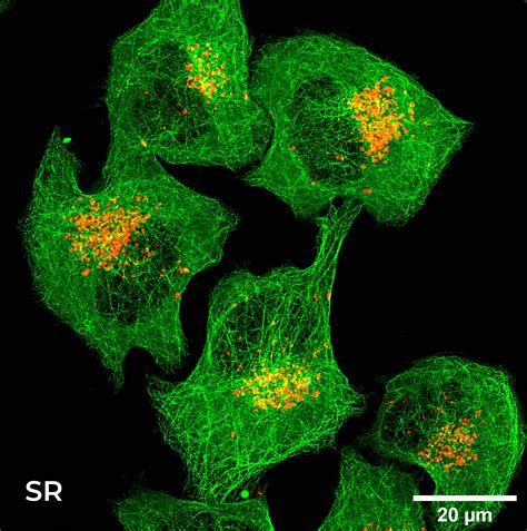 Live Cells Details And Dynamics With Structured Illumination Microscopy