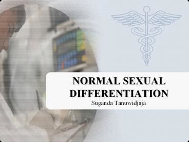 NORMAL SEXUAL DIFFERENTIATION Presentation Free To Download