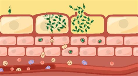 The Link Between Residual Urine And Utis