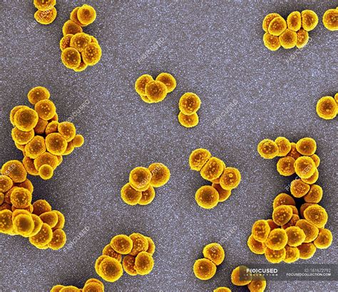 Research On Methicillin Resistant Staphylococcus Aureus