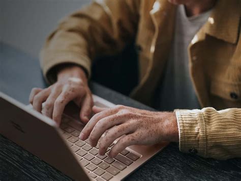 RFP Response Examples Strategies For Superior Results DeepStream