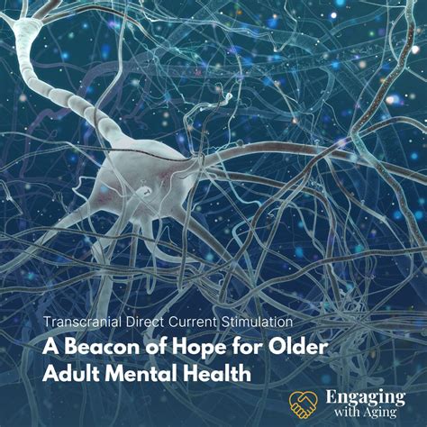 Engage With Skills Training Programs On Linkedin Transcranial Direct Current Stimulation A