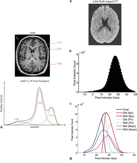 Figure 2 From Information The X Rays Give Head Ct Toward Making Full