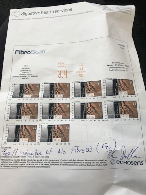 Fibroscan Different Numbers British Liver Trust