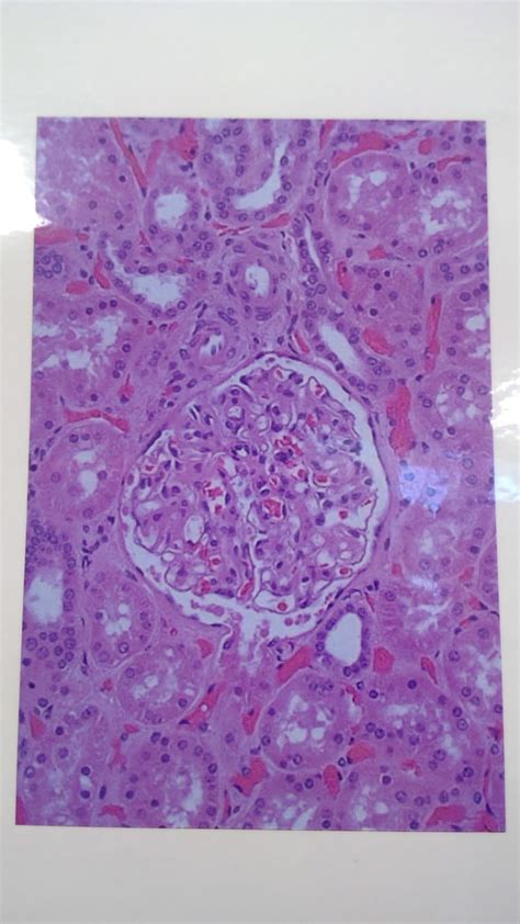 Renal Cortex Histology Slide Diagram Quizlet