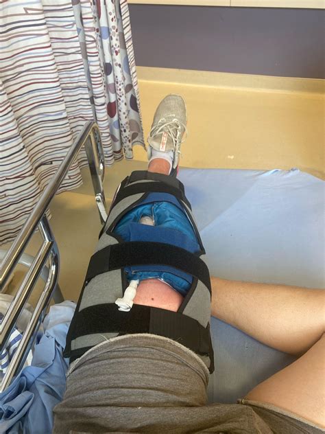 3rd Aclr 4 Years Finally R Acl
