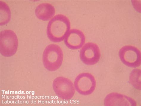 Hematologia