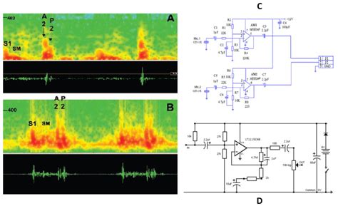 Mems And Ecm Sensor Technologies For Cardiorespiratory Sound Monitoring—a Comprehensive Review Pmc