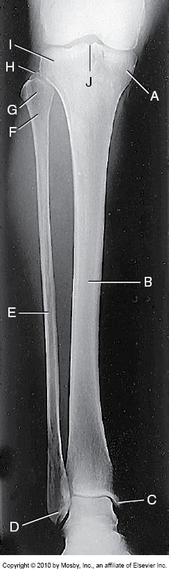Radiographic Anatomy Of The Tibia And Fibula Key Terms And Definitions Flashcards Quizlet