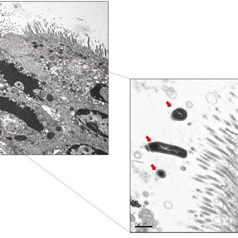 Osmium Tetroxide Staining Of Intestinal Sections Of Mice Download Scientific Diagram