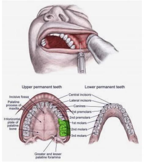 Dental Injection Sites And Names At Terri Whobrey Blog