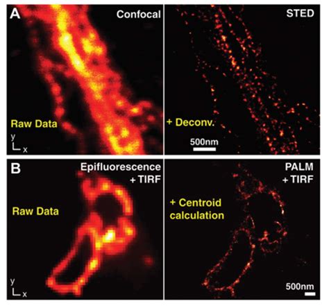 Comparison Between Conventional Fluorescence Microscopy And Download Scientific Diagram