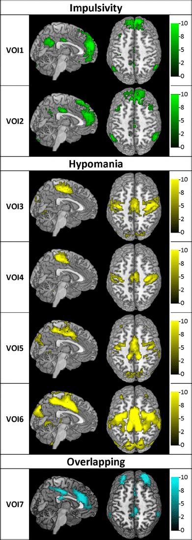 Voxel Wise Functional Connectivity Patterns For Each Of The Six Download Scientific Diagram