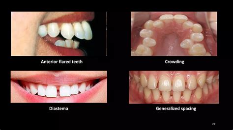 Aesthetic Problem Solving Part 1 Ppt