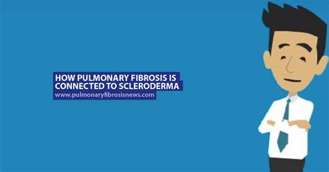 How Pulmonary Fibrosis Is Connected To Scleroderma Pulmonary Fibrosis News