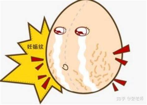 妊娠纹是什么 知乎