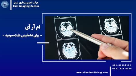 ام آر آی برای تشخیص سردرد