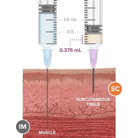 Subcutaneous Sq Vs Intramuscular Im Injection